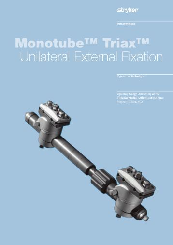 Dynamic Joint Distractor II External Fixation System - Stryker