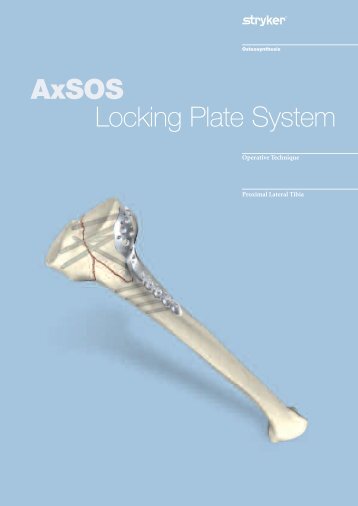 3.5 mm LCP Medial Proximal Tibia Plates Technique Guide - Synthes