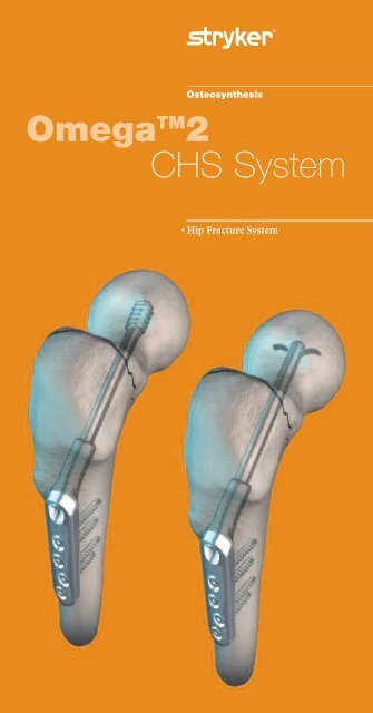OmegaTM2 CHS System - Stryker