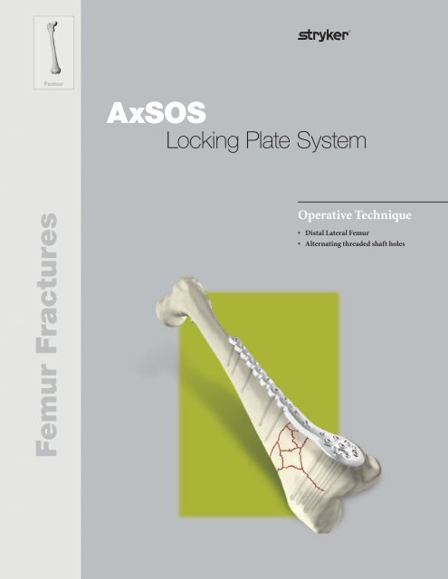 AxSOS Distal Lateral Femur Threaded Shaft Holes Operative - Stryker