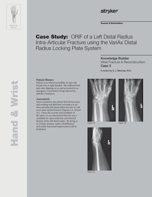 ORIF of a Left Distal Radius Intra-Articular Fracture - Stryker
