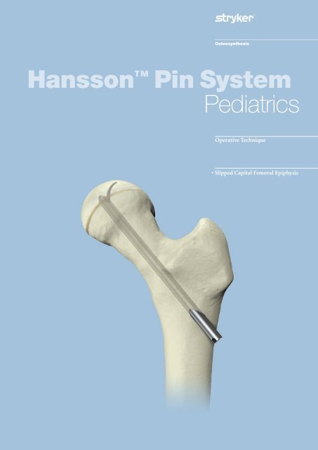 Hansson Pin Pediatric - Stryker