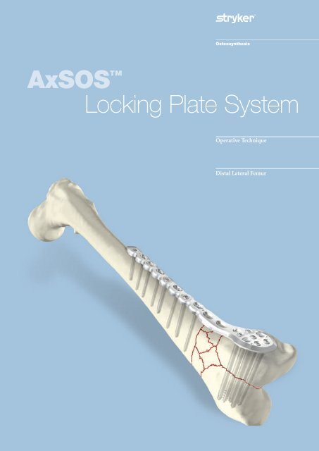AxSOS™ Locking Plate System - Stryker