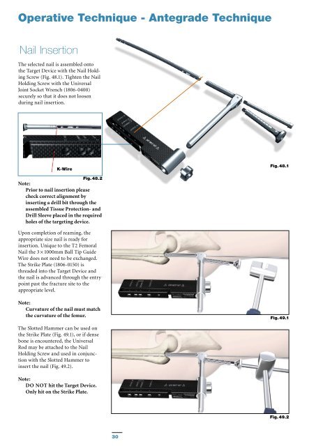 Operative Technique - Ant