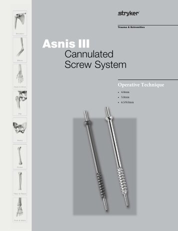 Asnis III Cannulated Screw System - Osteosyntese