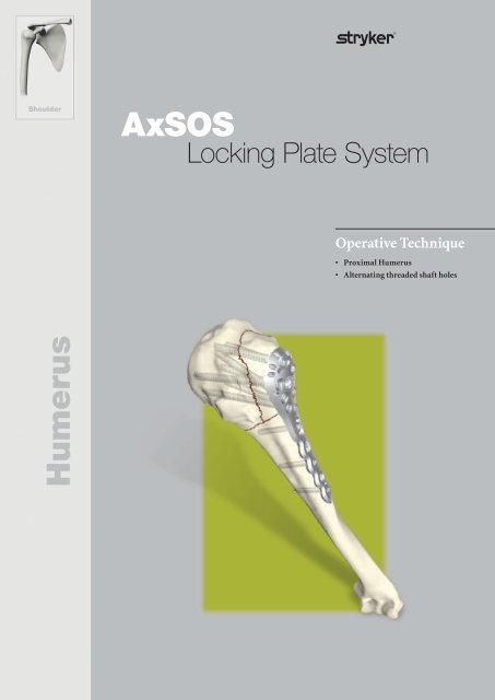 AxSOS Proximal Humerus TS Operative Technique - Stryker