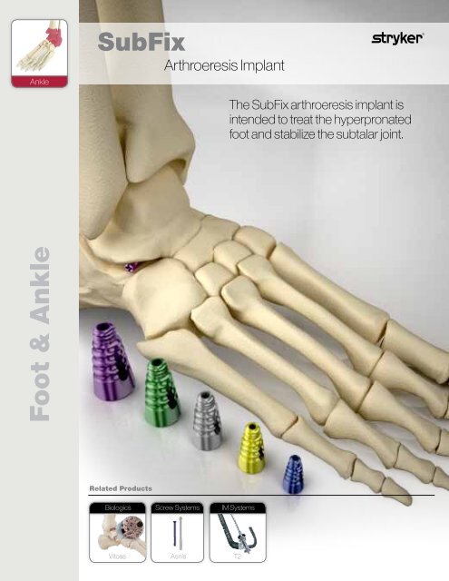 SubFix Arthroeresis Implant Sales Sheet - Stryker