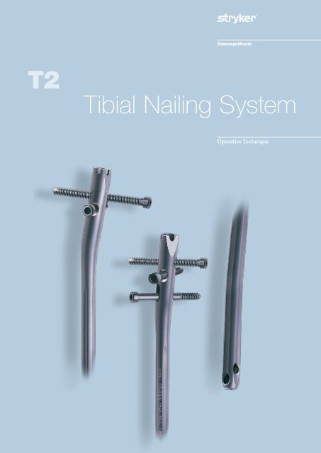 T2 Tibial Nailing System - Stryker