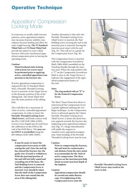 Operative Technique Dynam