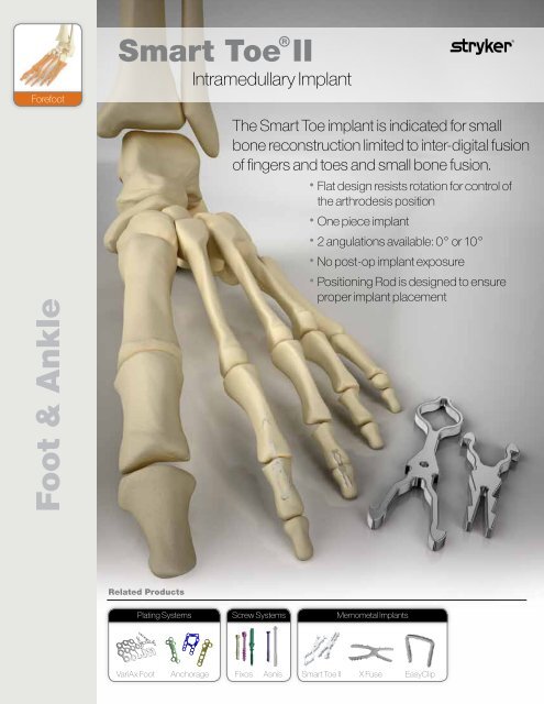 Smart Toe ® II - Stryker