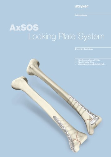 Dynamic Joint Distractor II External Fixation System - Stryker