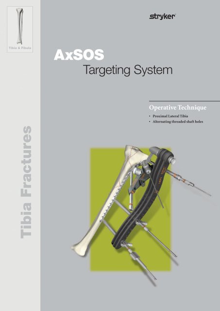 AxSOS Targeting System Proximal Lateral Tibia Operative ... - Stryker