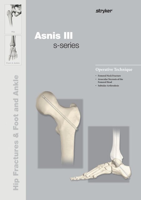 Asnis III S Series Operative Technique - Stryker