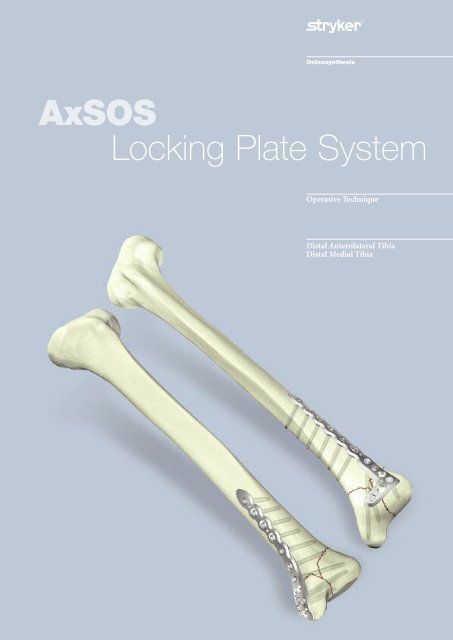 AxSOS Distal Tibia Operative Technique - Stryker