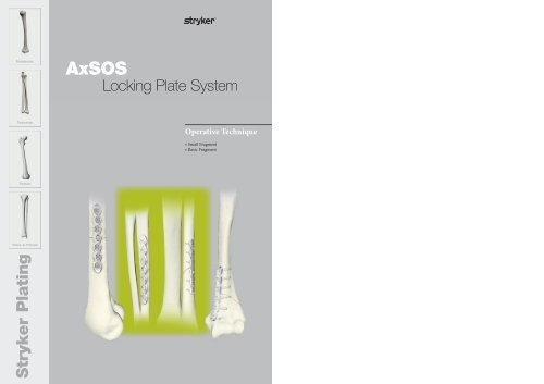 AxSOS Straight Plates Operative Technique - Stryker