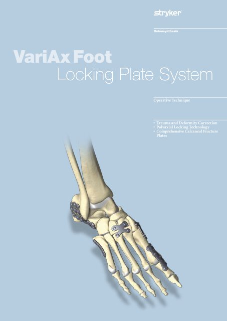 Variax foot locking plate system - Stryker