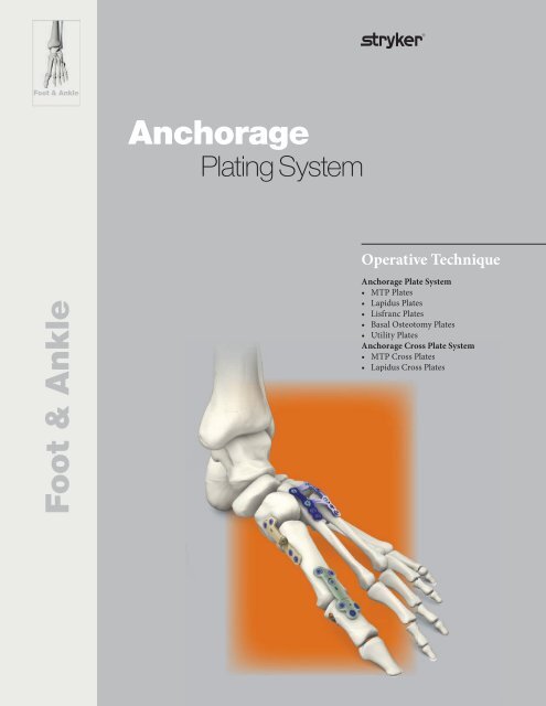 Anchorage Foot Plates Operative Technique - Stryker