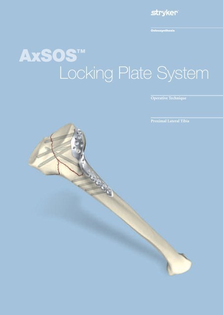 Proximal Tibia - Stryker
