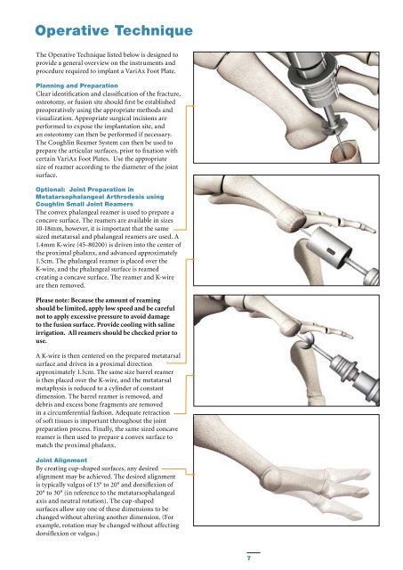 Indications The VariAx Fo