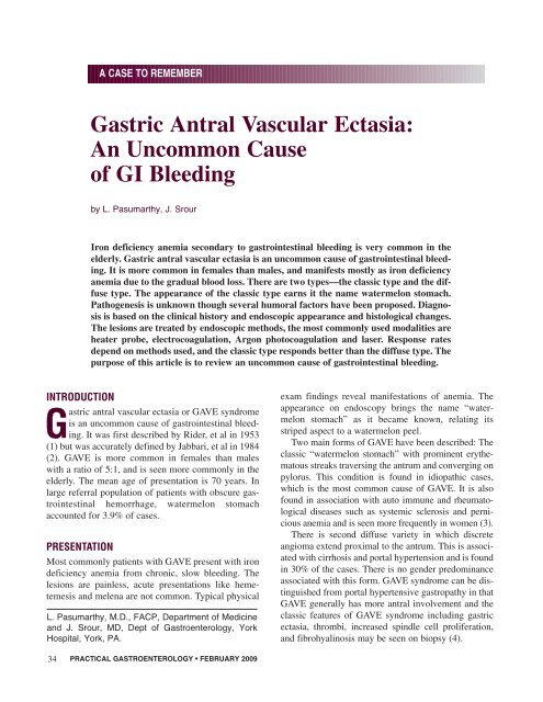 Gastric Antral Vascular Ectasia Practical Gastroenterology