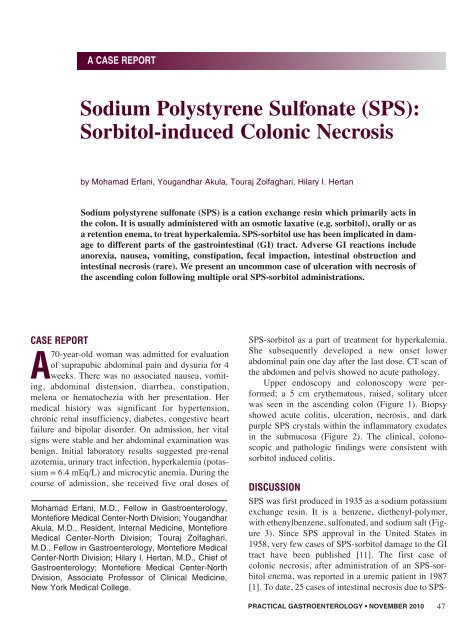 Sodium Polystyrene Sulfonate - Practical Gastroenterology
