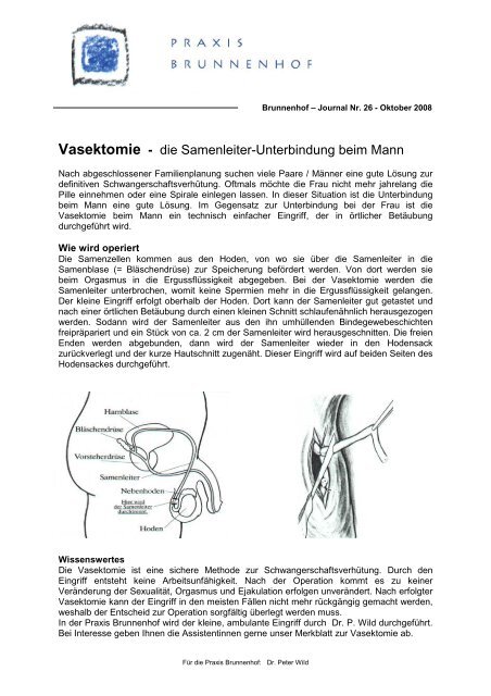 Vasektomie - Praxis Brunnenhof Herisau