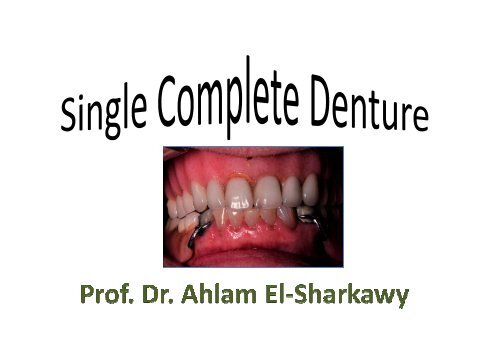 1- Maxillary single denture opposing natural teeth