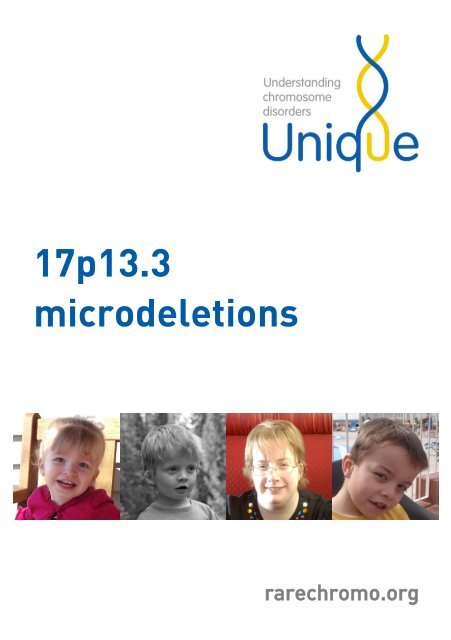 17p13.3 microdeletions - Unique - The Rare Chromosome Disorder ...