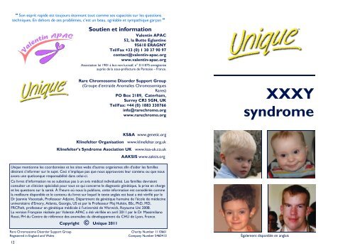 XXXY syndrome - Unique - The Rare Chromosome Disorder ...