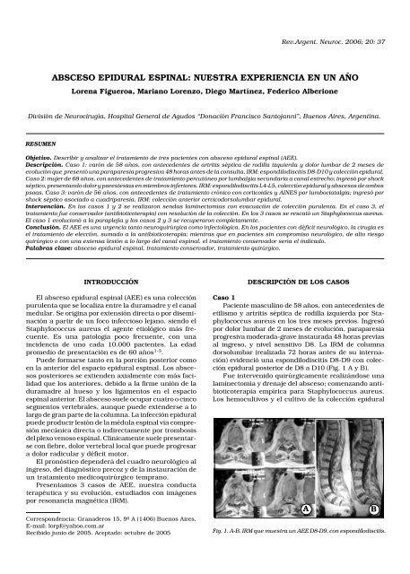 absceso epidural espinal: nuestra experiencia en un aÃ±o - SciELO