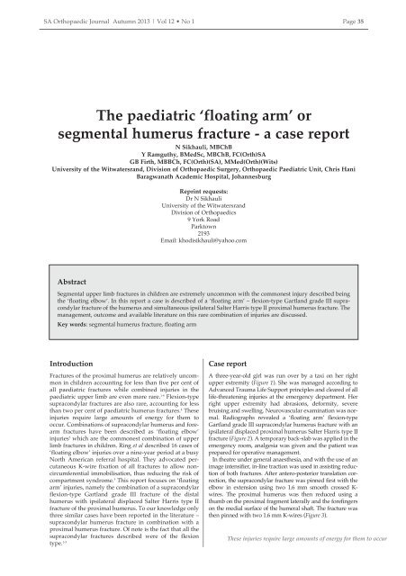 Or Segmental Humerus Fracture A Case Report