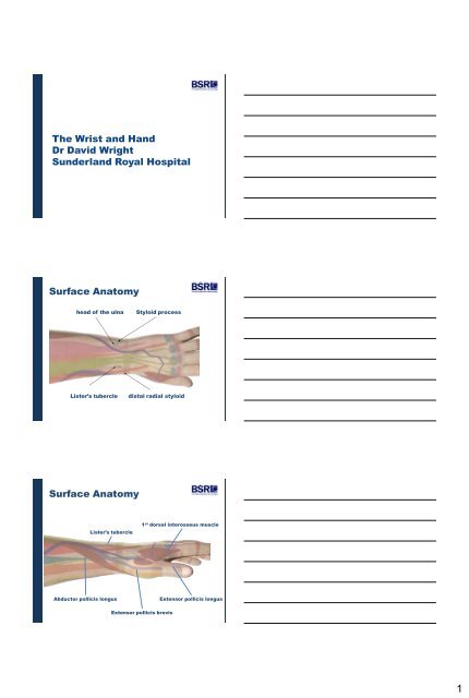 The Wrist and Hand Dr David Wright Sunderland Royal Hospital ...