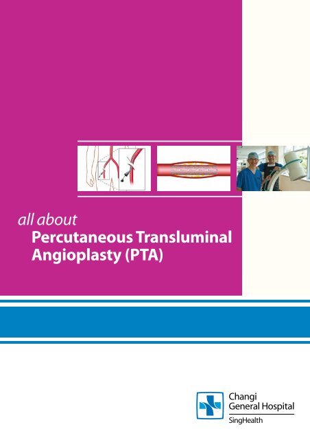 all about Percutaneous Transluminal Angioplasty (PTA)