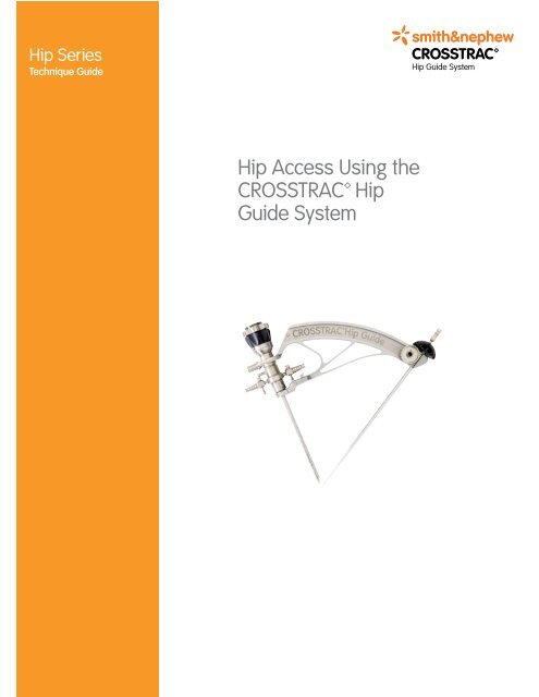 Hip Access Using the CROSSTRACâ ¢ Hip Guide System