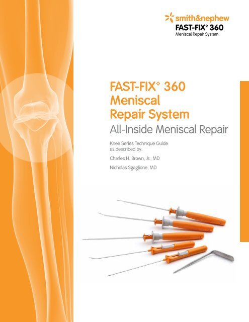 FAST-FIXâ ¢ 360 Meniscal Repair System - Smith & Nephew