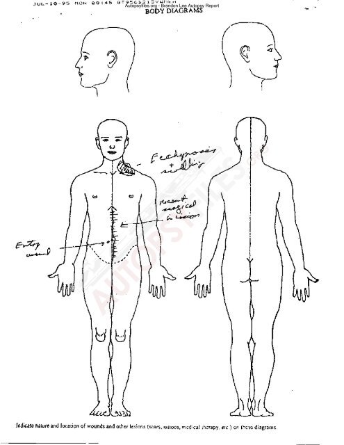 Autopsyfiles.org - Brandon Lee Autopsy Report
