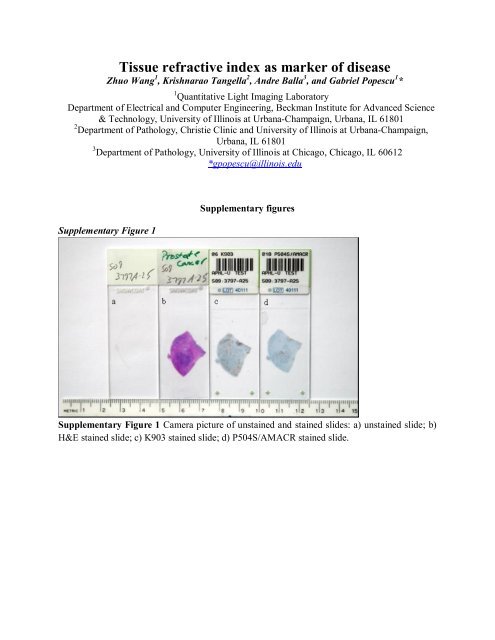 Tissue refractive index as marker of disease - Quantitative Light ...