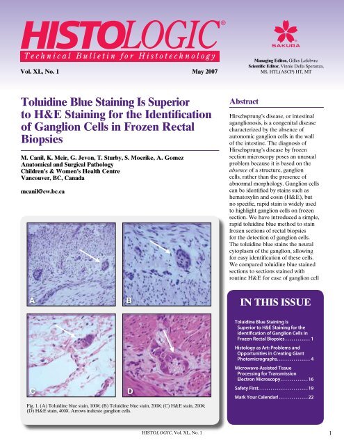 Toluidine Blue Staining Is Superior to H&E Staining for ... - IHC World