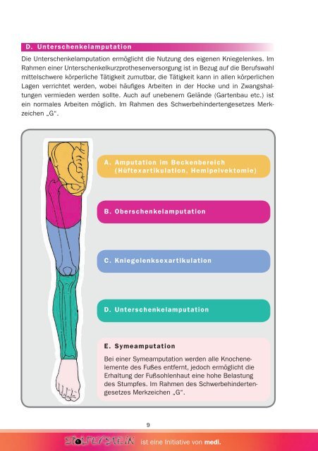 3. Amputationshöhen und