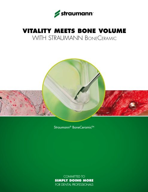 LIT262 Bone Ceramic Vitality Brochure - Straumann