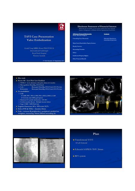 TAVI Case Presentation Valve Embolization - summitMD.com