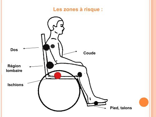 Les zones à risque : Dos