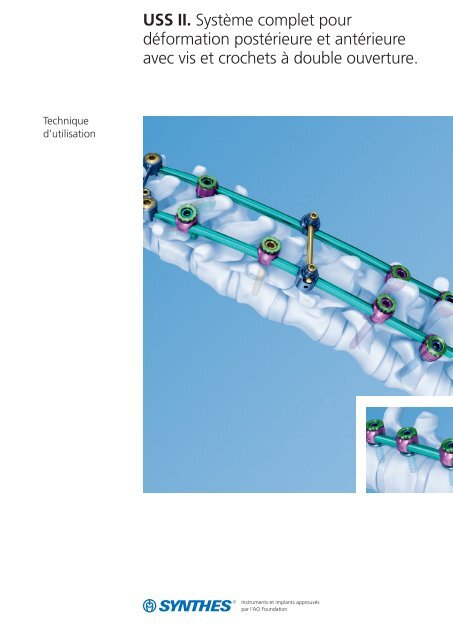 Technique opératoire - Synthes