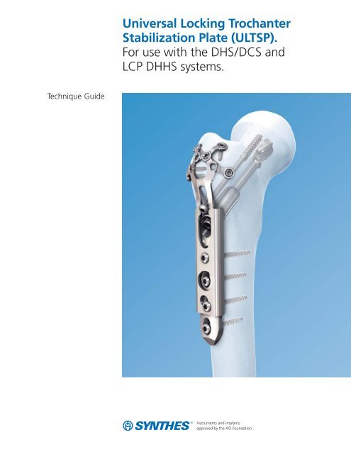Universal Locking Trochanter Stabilization Plate (ULTSP ... - Synthes
