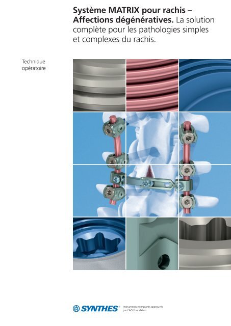 Technique opératoire - Synthes