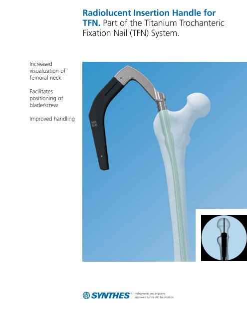 radiolucent insertion handle for tfn brochure - Synthes