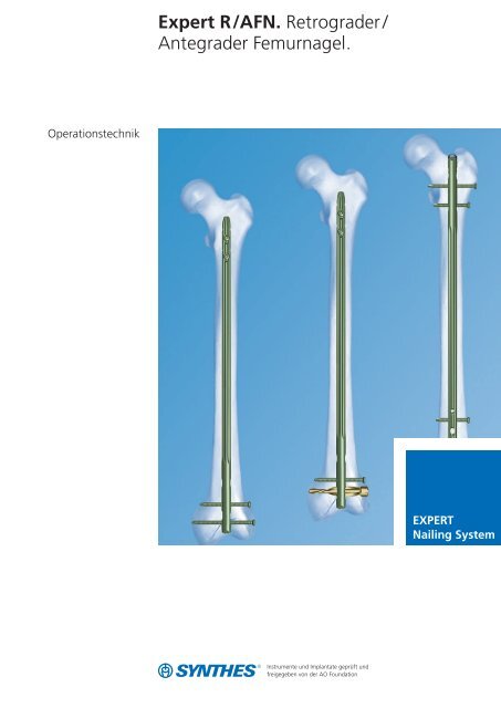 Expert R/AFN. Retrograder / Antegrader Femurnagel. - Synthes