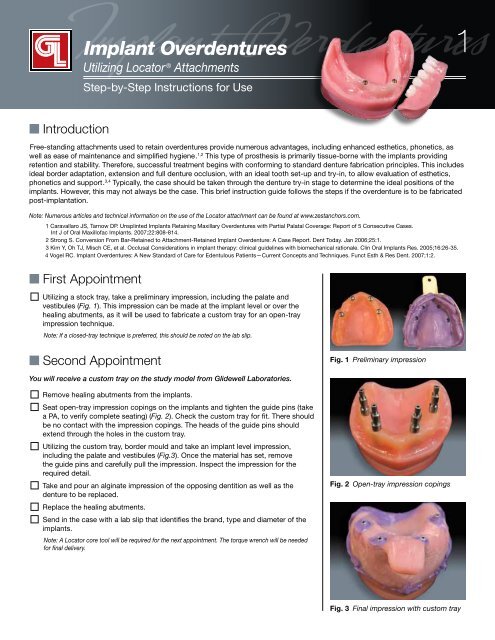 Implant Overdentures - Glidewell Dental Labs