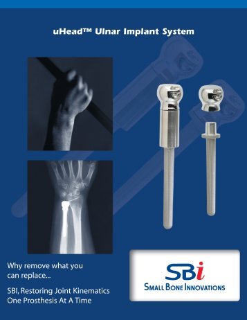 STRAUMANN® BONE LEVEL IMPLANT PROSThETIc OPTIONS ...