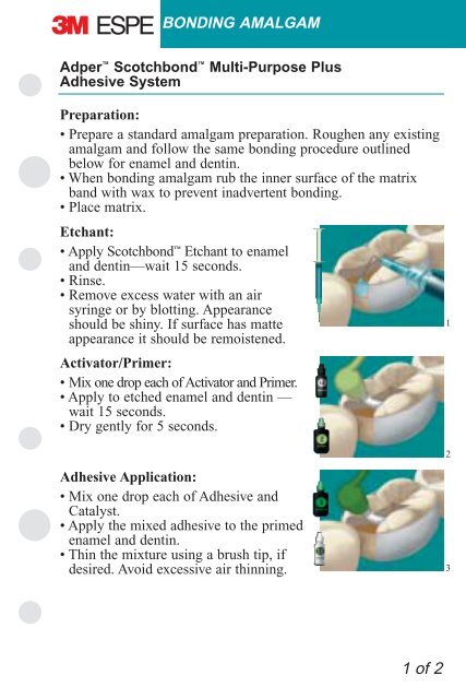 Bonding Amalgam